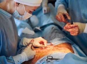 ICMR Study Reveals High Surgical Site Infection (SSI) Rates in Indian ...